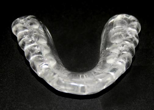 Férula, guarda o placa oclusal ¿Qué son? | Odontologia Salud y Hoy!