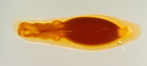 Acanthocephala ~ Dunia Hewan