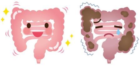 ASUHAN KEPERAWATAN PADA PASIEN OBSTRUKSI USUS | Asuhan Perawat