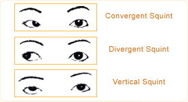 B. C. D. E. That's Us!: Strabismus, Squint and The Journey of Eye Patching