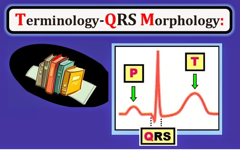 ECG Interpretation: ECG Blog #88 (Basics-1) – QRS Terminology