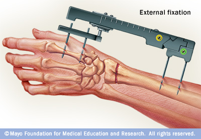 Fracture/Dislocation/Sublaxation ~ Anatomy for MSP