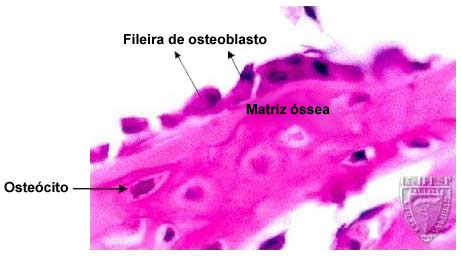 Envelhecimento: Osteoporose