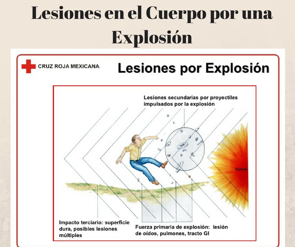 Traumatología Médico-Legal (UNED,CR-2017): Traumatología Forense ...