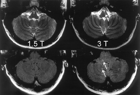 Dr Balaji Anvekar FRCR: MY PARENT INSTITUTE 3T MRI