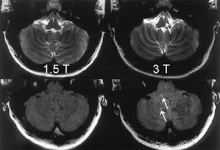 Dr Balaji Anvekar FRCR: MY PARENT INSTITUTE 3T MRI