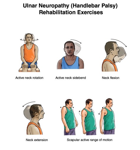 EXCLUSIVE PHYSIOTHERAPY GUIDE FOR PHYSIOTHERAPISTS: EXERCISE FOR ULNAR ...