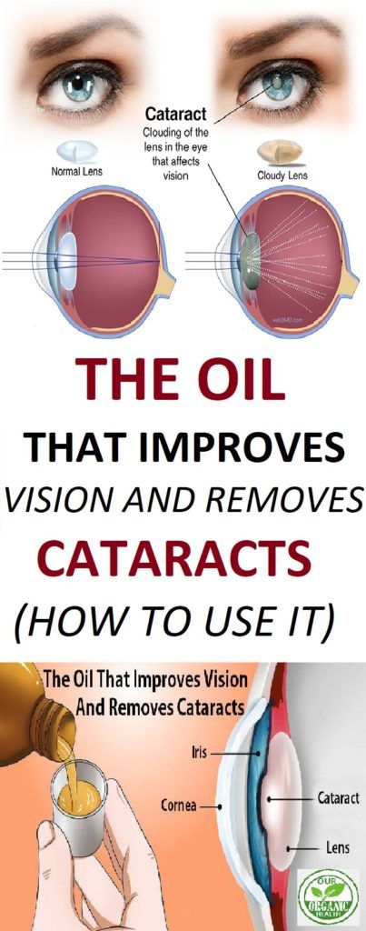THE OIL THAT IMPROVES VISION AND REMOVES CATARACTS (HOW TO USE IT ...