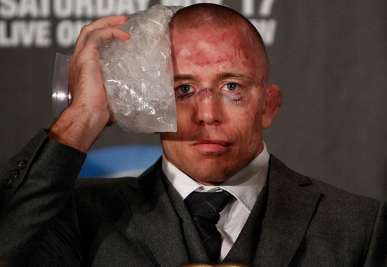 Funny faces of MMA | Sherdog Forums | UFC, MMA & Boxing Discussion