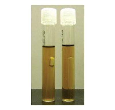 Media Lactose Broth ~ Medical Laboratory Technologist