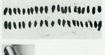 DVP's JFK ARCHIVES: THE BULLET FRAGMENTS IN GOVERNOR JOHN CONNALLY