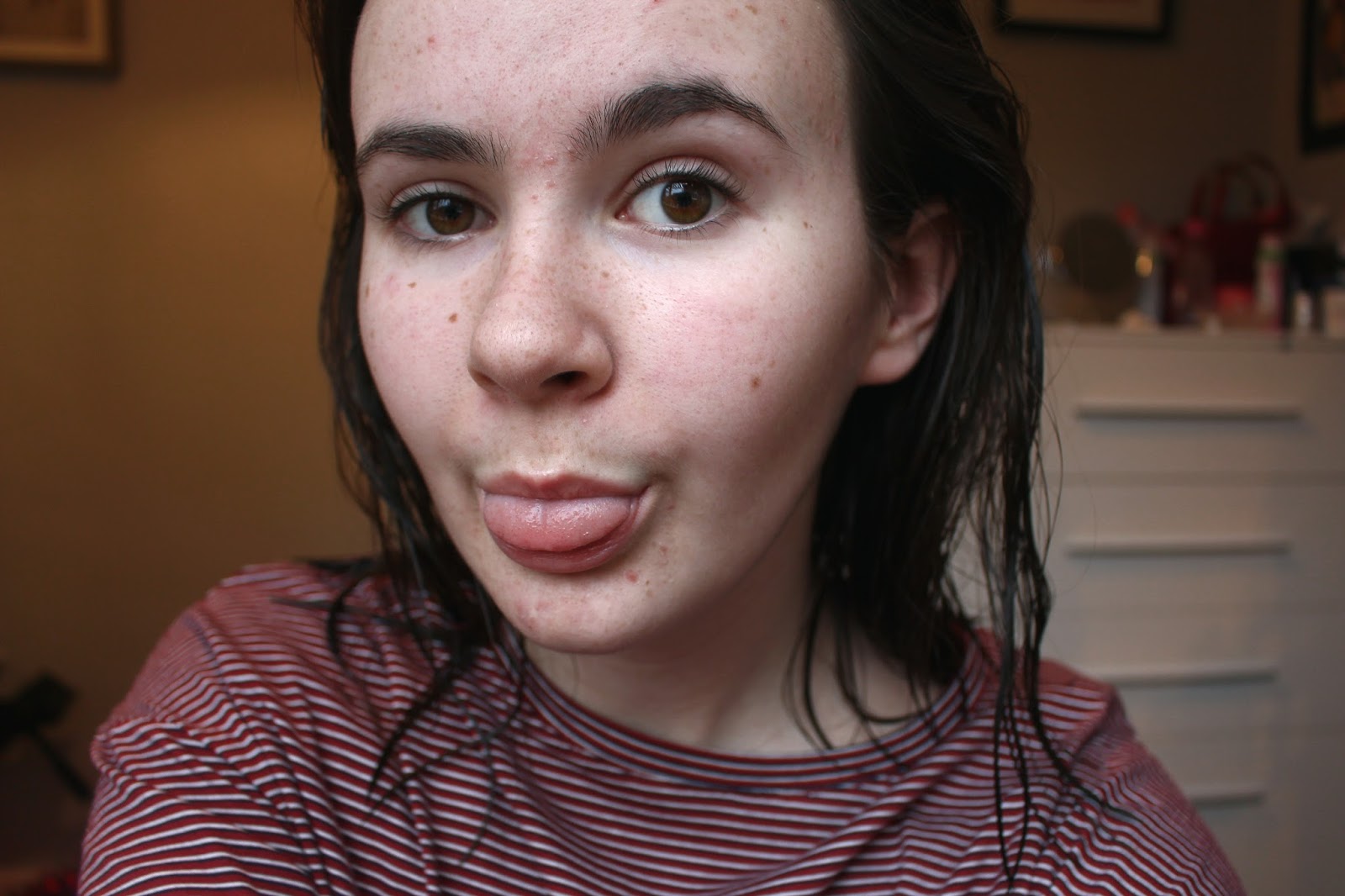 Embrace the bare face: Acne edition / Lucy Jane Fashion 🍒