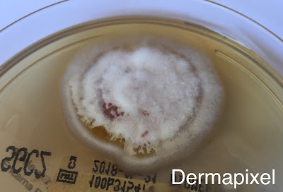 Dermapixel: junio 2018