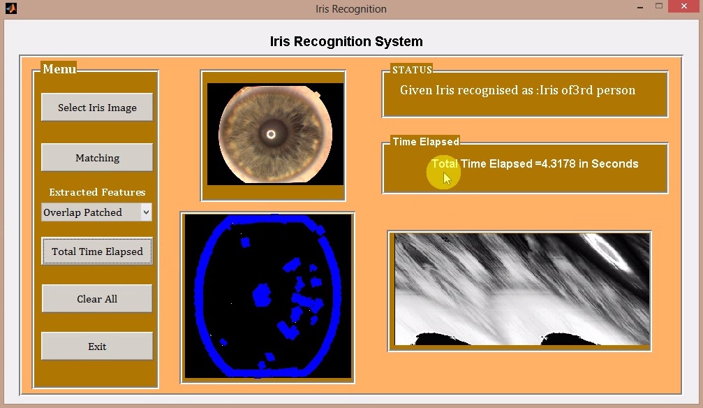 Iris Recognition Using Discrete Cosine Transform Dct Matlab Project