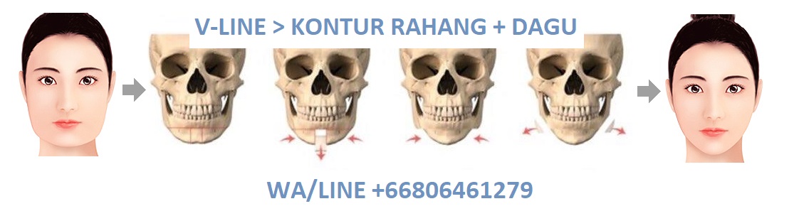 KOORDINASI MEDIS & OPERASI PLASTIK MR.GHANY: RAHANG
