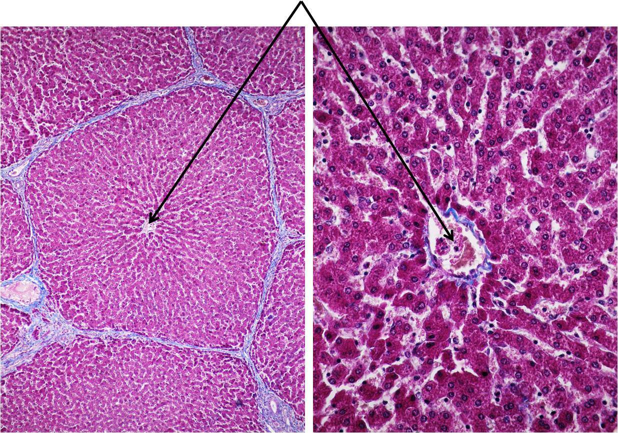 Fisiología de Omar Báez: Lobulillo Hepático