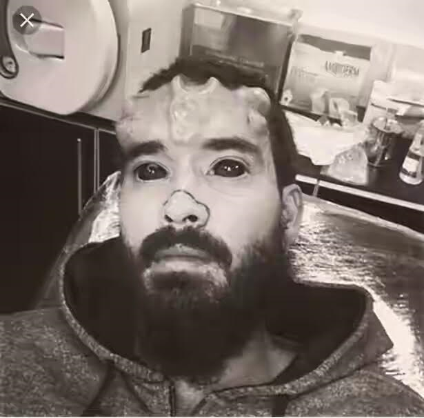 Photos: Venezuelan man spends over ?30K in a bid to look like Red Skull