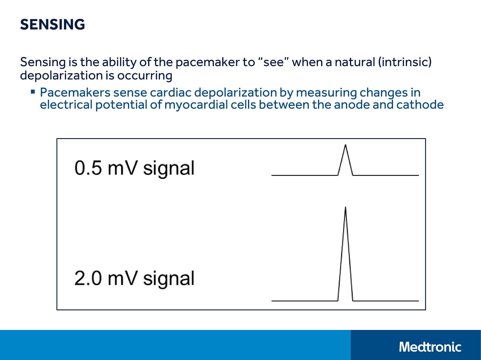 CVT Mohd Farid: Basic Pacing Concepts Part II-Medtronic Academy