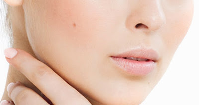 Well-being: How to Get Rid of Pimples, Moles, Freckles, or Wrinkles on ...