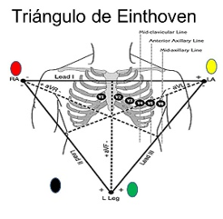 EKG FROM 3 DERIVATES ( BIPOLAR DERIVATES)