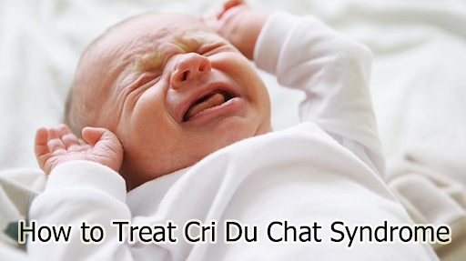 How to Treat Cri Du Chat Syndrome