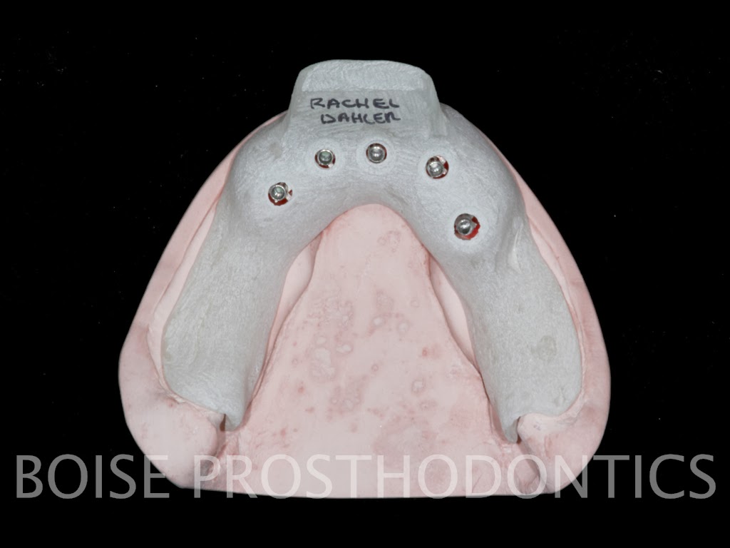 Boise Idaho Prosthodontics: Mar 4, 2012