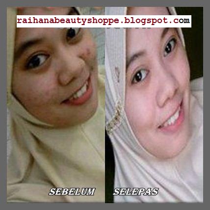 KECANTIKAN dan wanita tidak dapat dipisahkan: ~ KRIM UV WHITENING ...