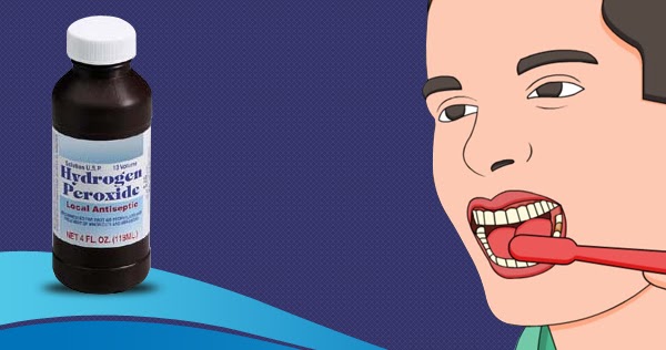 4 Easy Tips to Clean Your Mouth with Hydrogen Peroxide ~ Dental Blogs ...