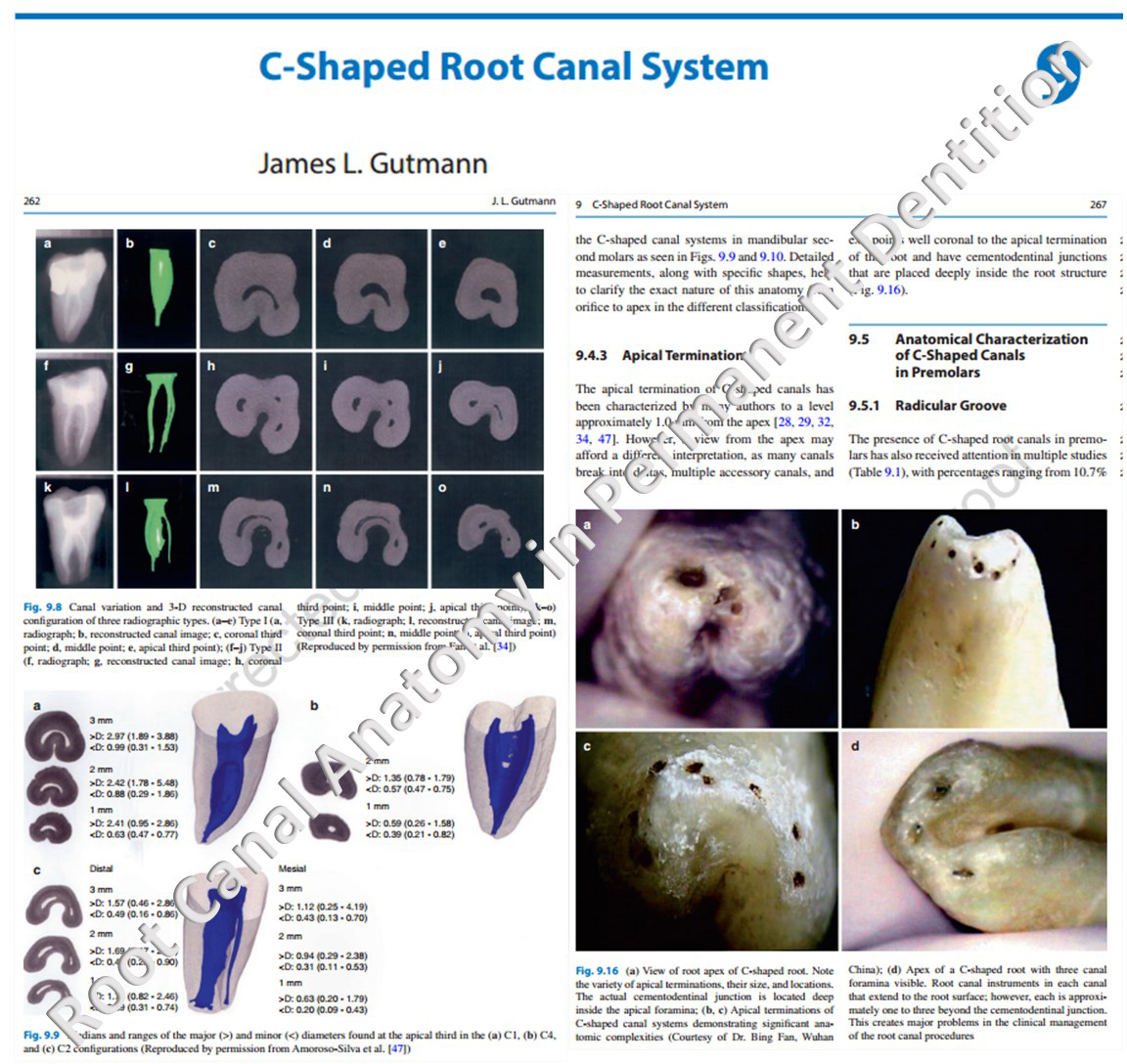 The Root Canal Anatomy Project: 2018