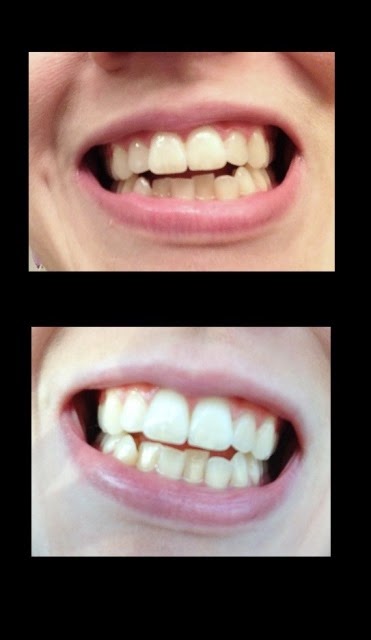 I Want to Look Like Her: Colgate Optic White Toothbrush + Built-in ...