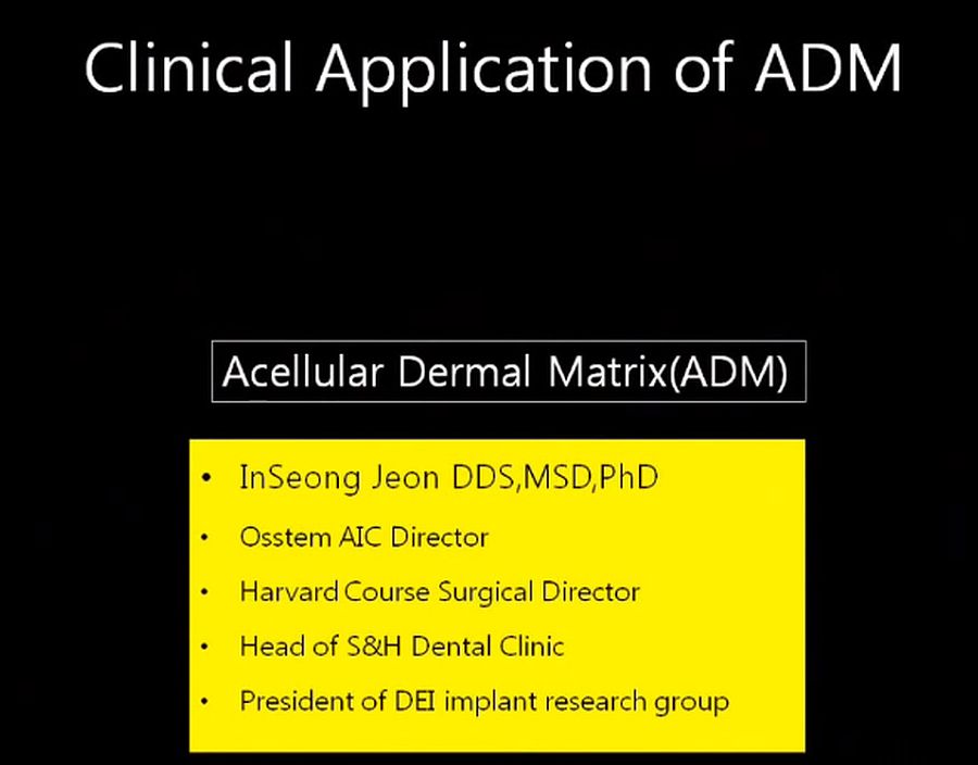 SUREDERM: Clinical Application of ADM - Dr. Jeon, In-seong - Odonto-Tv