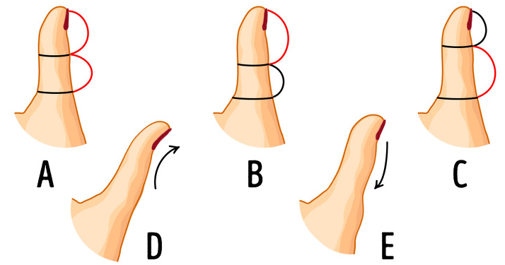 You Must Know! The Length of Your Little Finger Determines Your Health ...