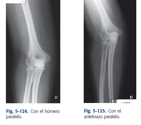 PRODUCCION Y TRATAMIENTO DE IMAGENES DIAGNOSTICAS: CAPITULO EXTREMIDAD