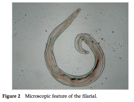 Parasitology BIO 340: Filarial Worm or Cataract?