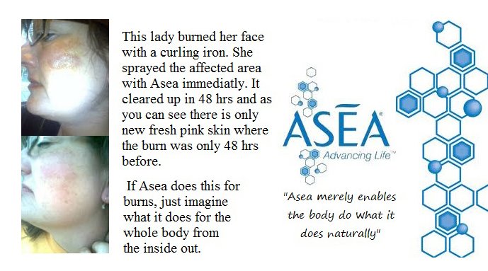 The Redox Molecule Advantage: Learn The New Super Healing Spray From ...