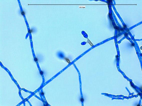 Fun With Microbiology (What's Buggin' You?): Ochroconis species