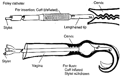 Embrio Transfer (TE), bag 2. - Mydokterhewan