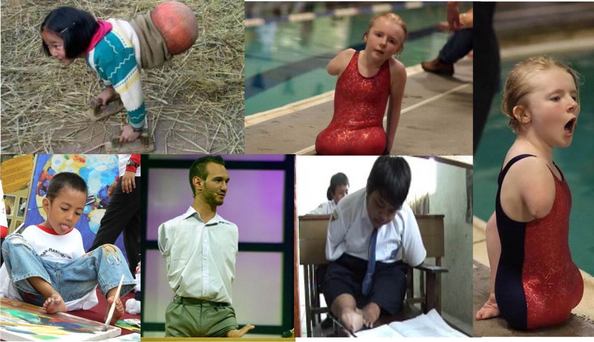 (Makalah 2)Menyikapi Penderita Disabilitas