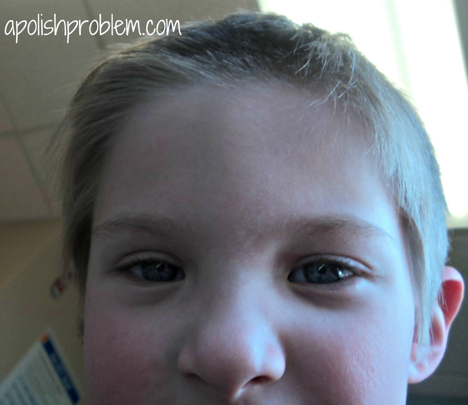 nails PC: A Face of Autism