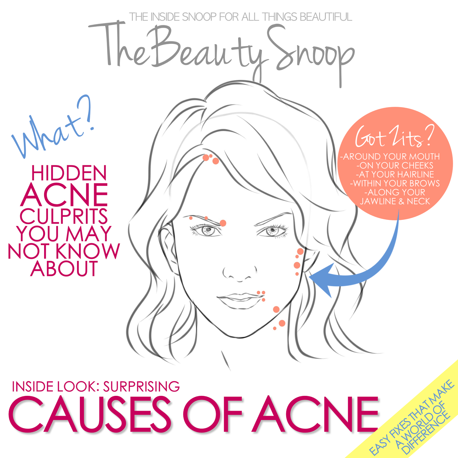 THE BEAUTY SNOOP: SURPRISING CAUSES OF ACNE- AND THE EASY FIXES YOU ...