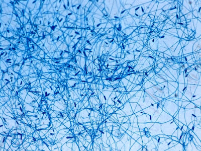 Fun With Microbiology (What's Buggin' You?): Epidermophyton floccosum