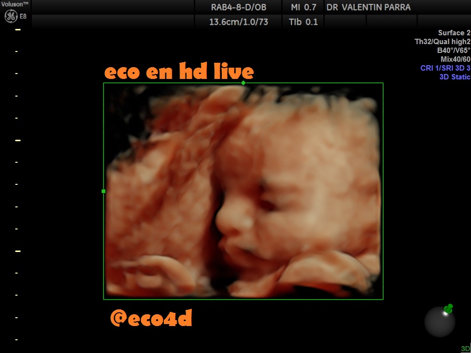 Ultrasonido Cuarta Dimension en Monterrey. ECO4D: Ecografia 2d, 3d, 4d ...