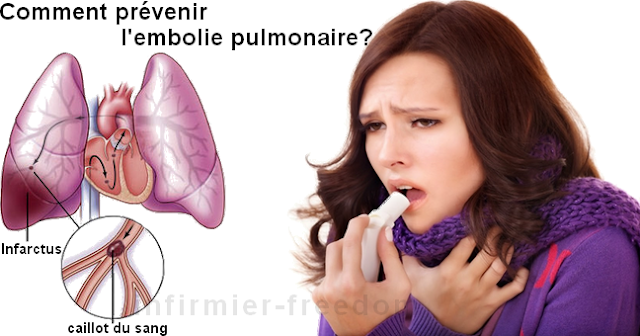 Comment prévenir l'embolie pulmonaire ~ Santé et les soins infirmiers