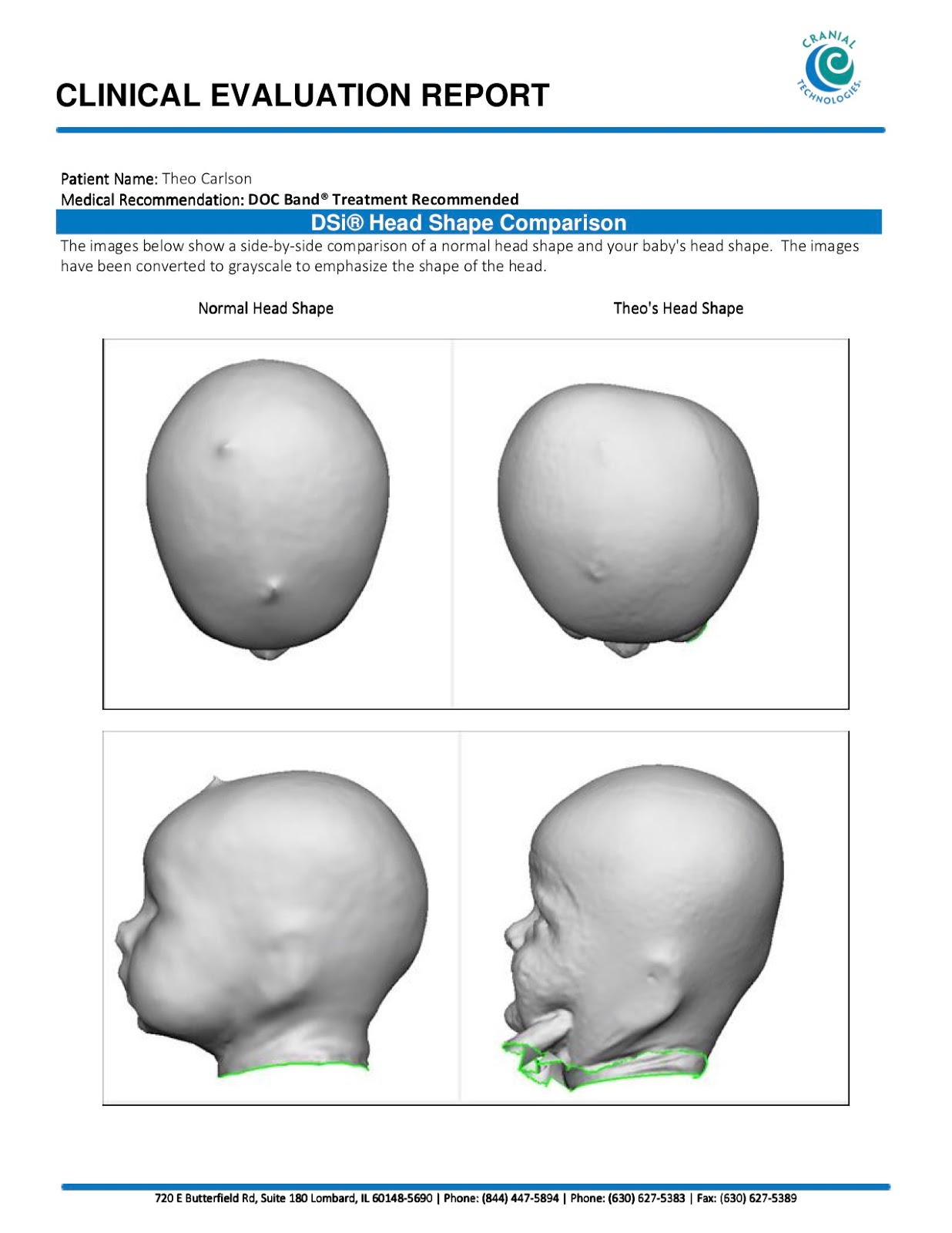 Here I am: Occupational Therapy Evaluation and Cranial Technologies