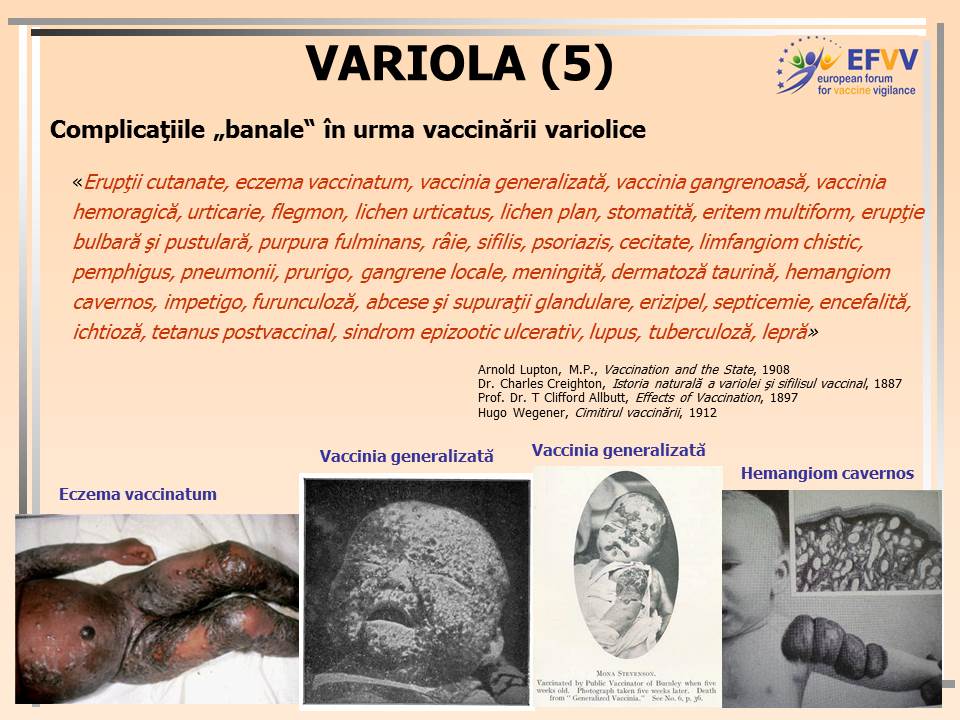 Sindromul Stevens-Johnson - vatamare vaccinala - Jurnal si introspectii ...