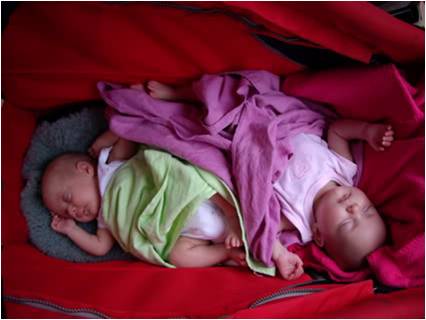 Monoamniotic Twins: 31 Ultrasounds Later...