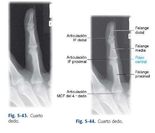 PRODUCCION Y TRATAMIENTO DE IMAGENES DIAGNOSTICAS: CAPITULO EXTREMIDAD