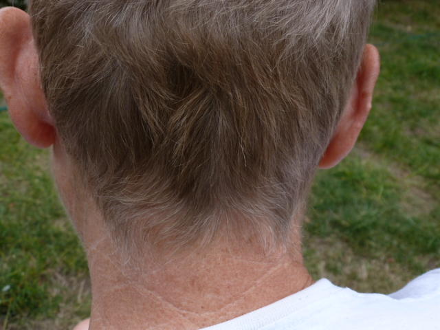 The adventures of a person with eclectic interests: Chemo hair regrowth