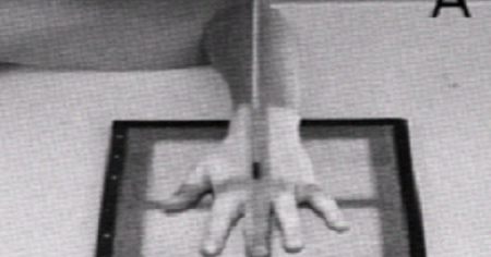 Teknik pemeriksaan X Ray Manus - Seputar Kesehatan