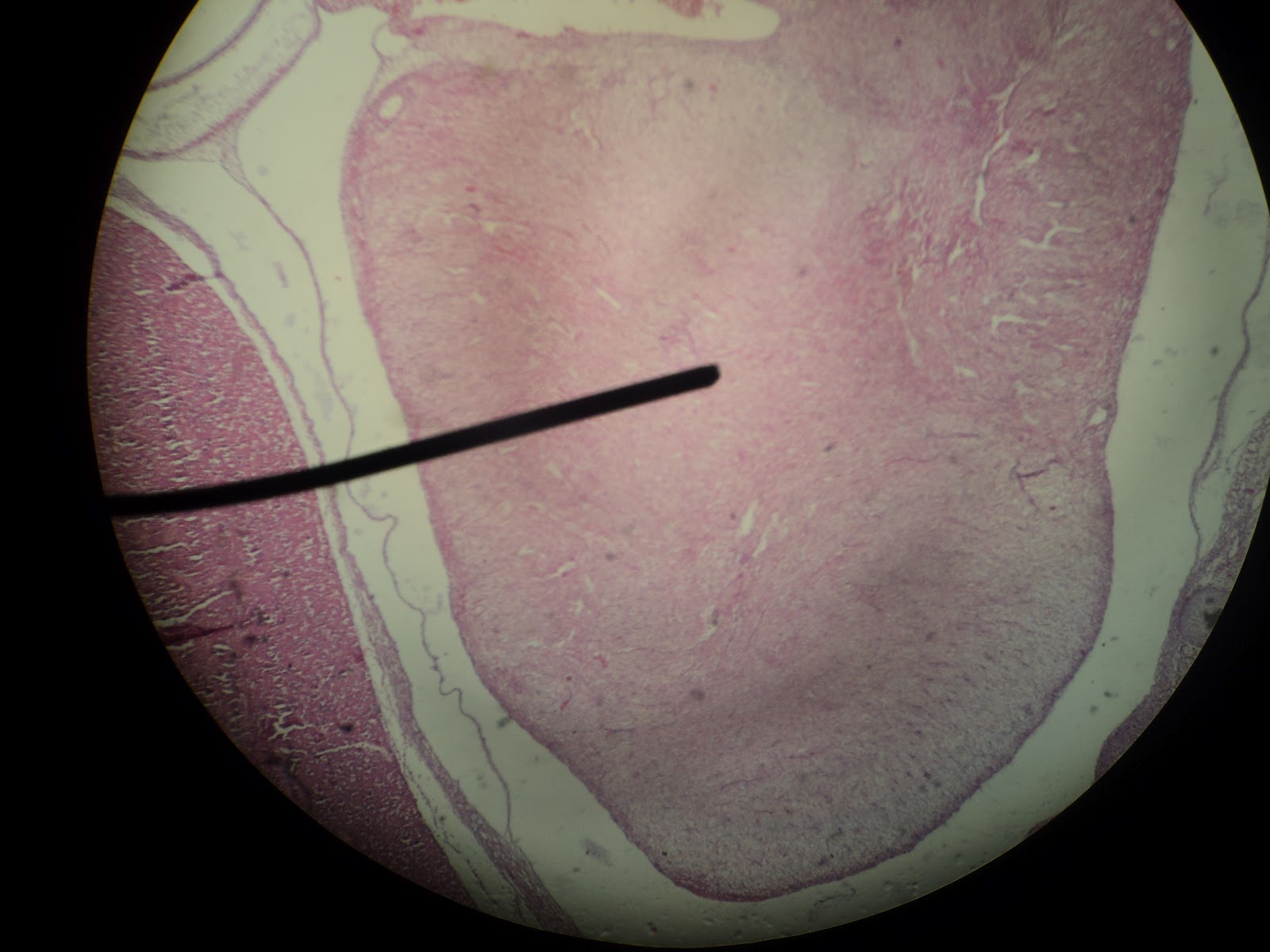 MEDICINA USMP: FOTOS DE EMBRIOLOGIA